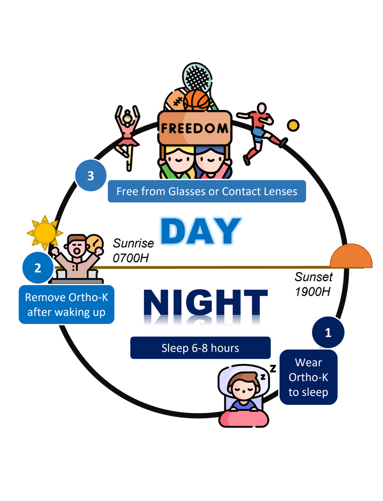 Ortho-K Lenses in Singapore | Night Time Contact Lenses